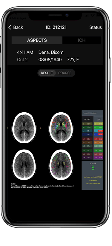 Neuroimaging Stroke Software Platform Powered by AI | RapidAI